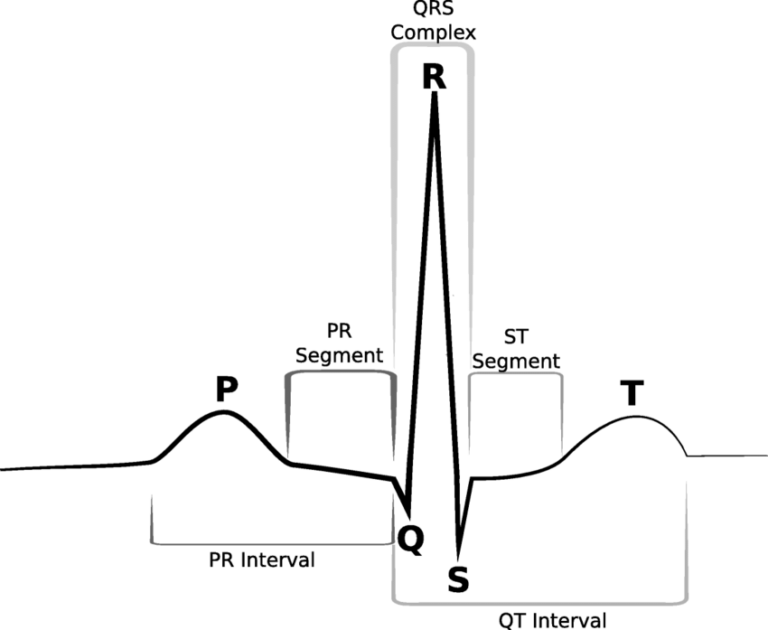 Electrocardiogram - Nucleus Diagnostics Centre